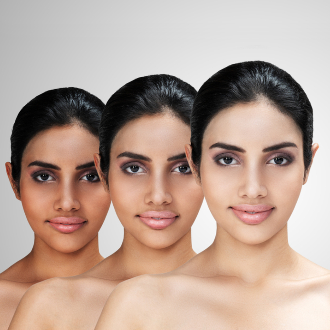 Reflections-Advanced laser and wellness centre | Best laser & cosmetic ...